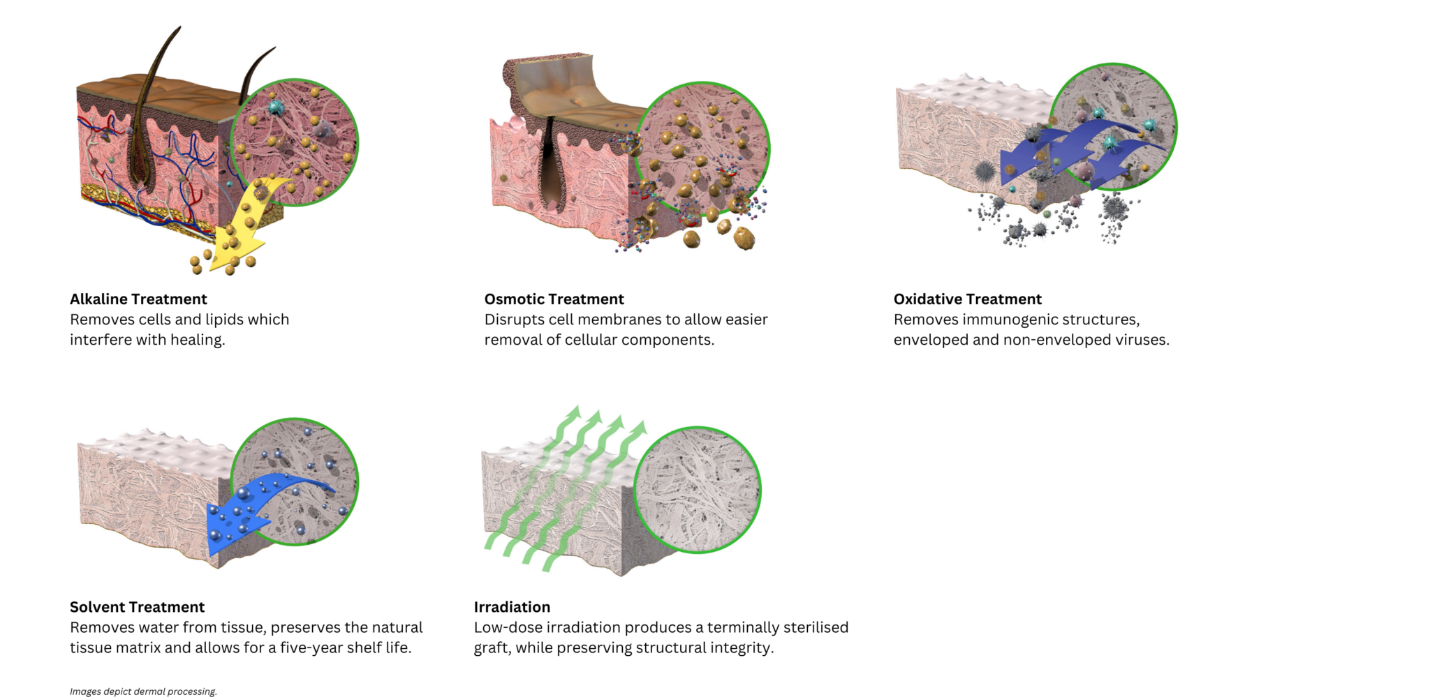 Tutoplast® - Hospital Innovations