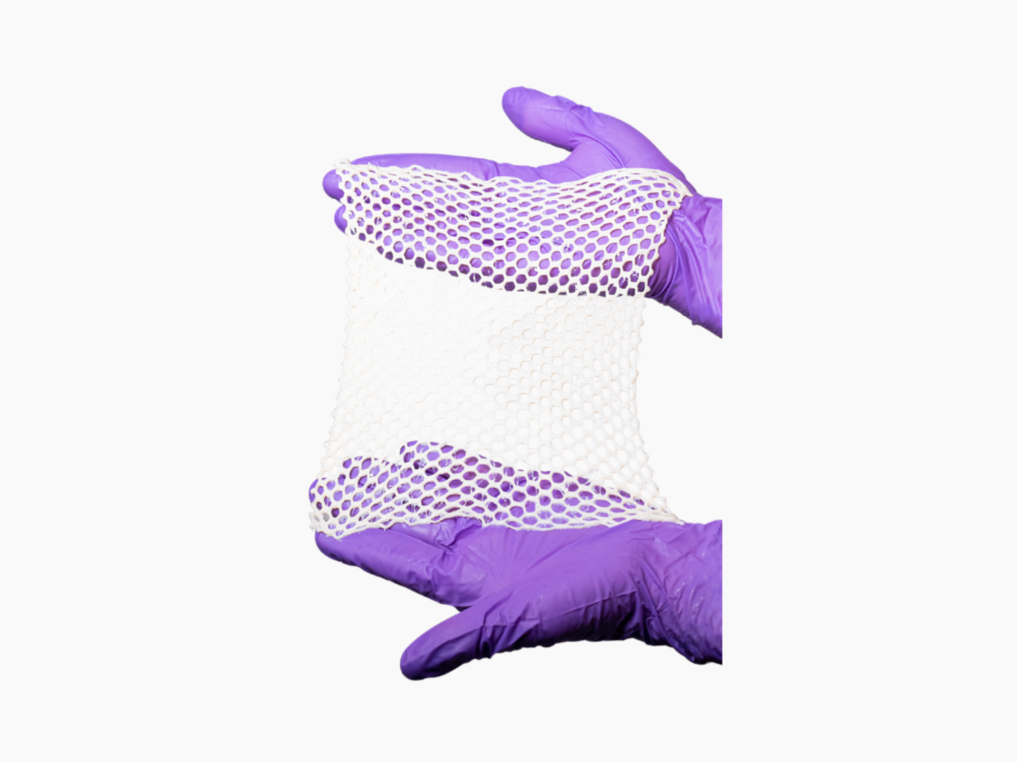 Comparing Complications in Acellular Dermal Matrices Used in Implant ...